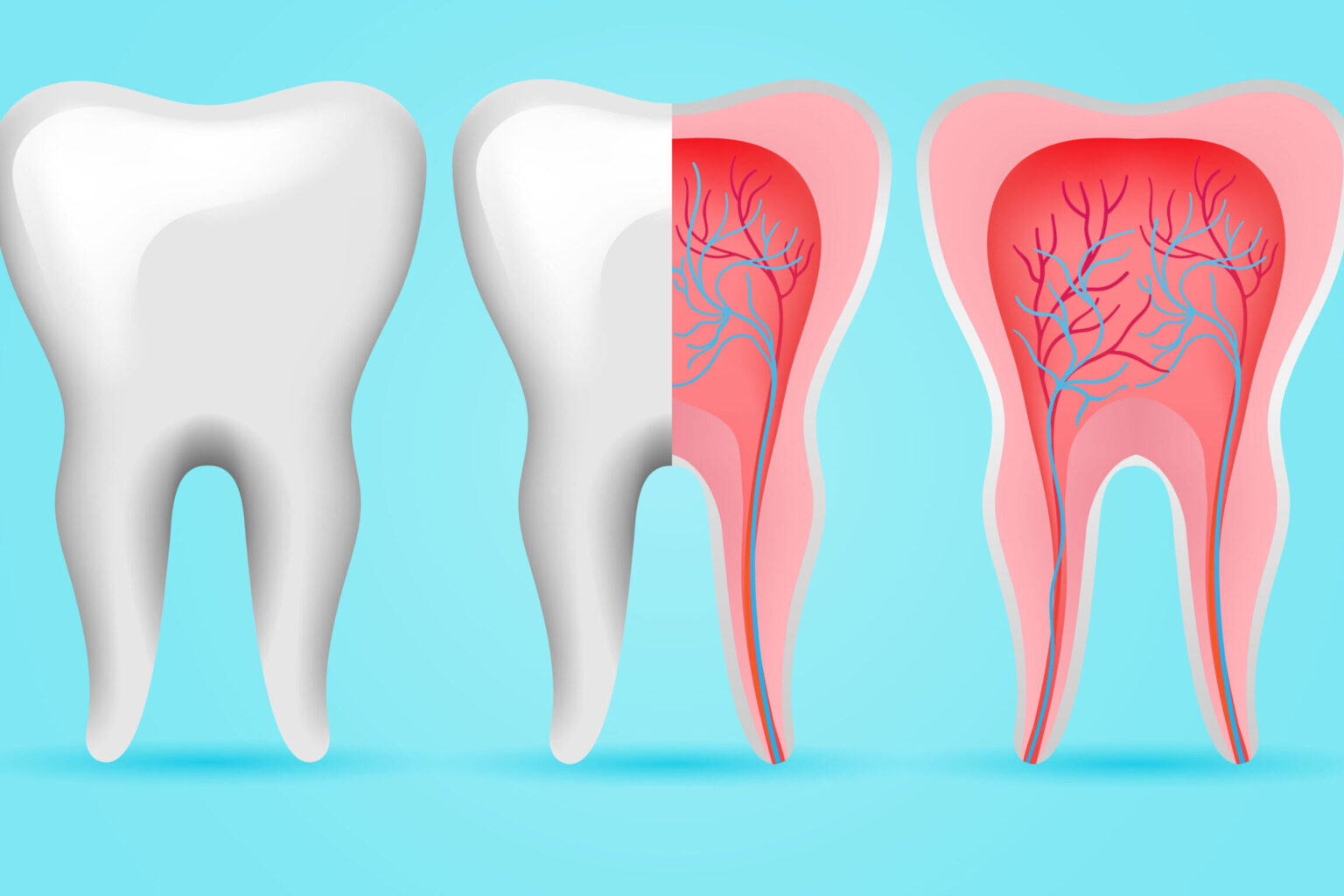 Descubre qué significa cuando se te rompe un diente y cómo actuar